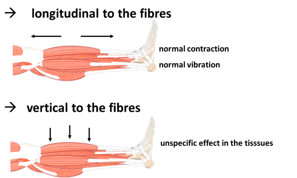 Physiotherapy Equipment - BMS Matrix