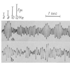 The vital role of the muscles micro-movements - BMS Matrix